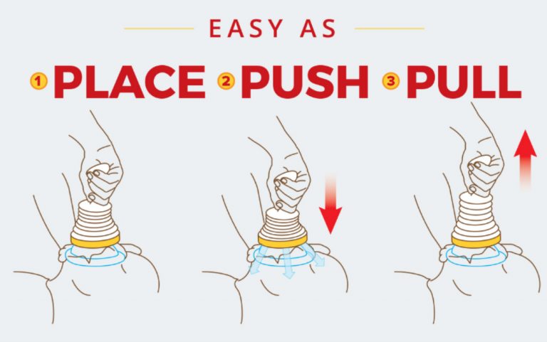 LifeVac: Anti-choking Airway Clearing Device - Tech Household